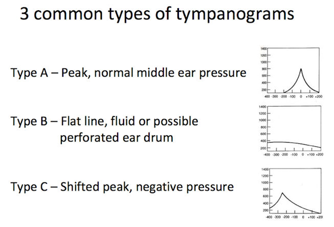 tympanometry | MESHGuides